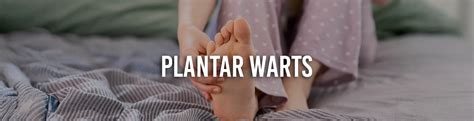 Plantar Warts Causes And Prevention And Treatment Strategies Medical Blogs