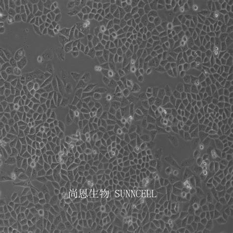 A2780细胞人卵巢癌细胞 武汉尚恩生物技术有限公司
