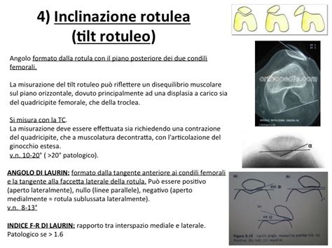 Studio Radiografico Del Ginocchio Radiologia Ortopedica
