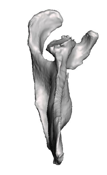 B2 Deformity Base Model Surgistud