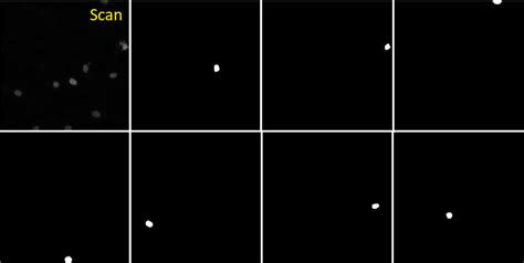 Semantic Segmentation To Detect Nuclei Using U Net By Stanislav