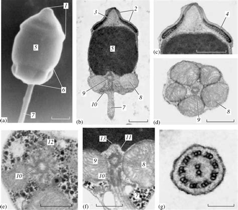Spermatozoon Of Phascolion Cryptus Sipunculida As An Example Of The