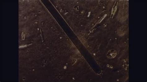 1960s United States Single Cell Algae Under Microscope Algae Joined