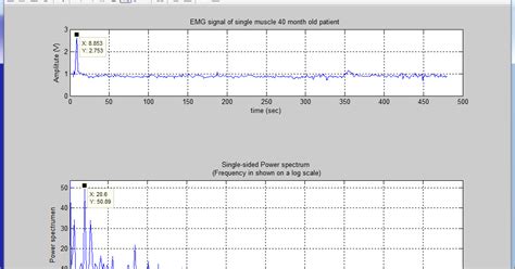 Biomedical Signal And Image Processing Projects Using Matlab And Labview Tools Matlab Code To