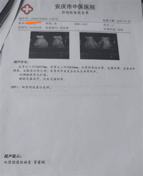 中西医结合治疗 慢性肾衰疗效佳安庆市中医院