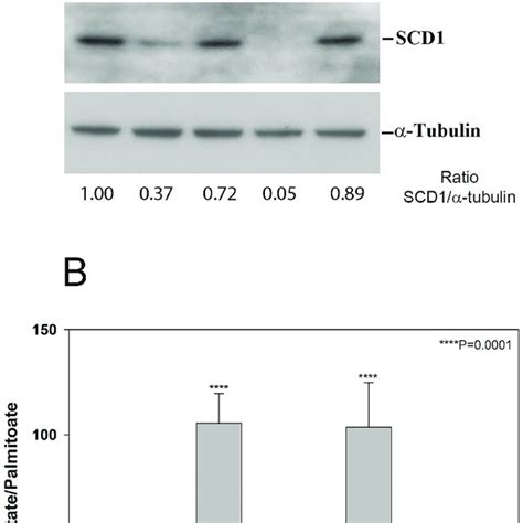 Effect Of Fenretinide And Its Metabolites On Des1 Activity Arpe 19