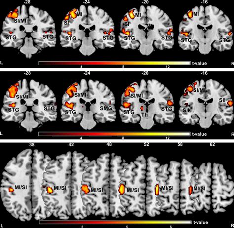 Task Related Brain Activation For The Different Conditions And