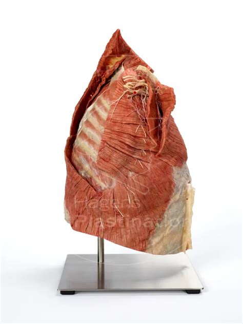 Thoracic Wall Half