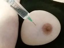 Saline Injection Tube Search Videos