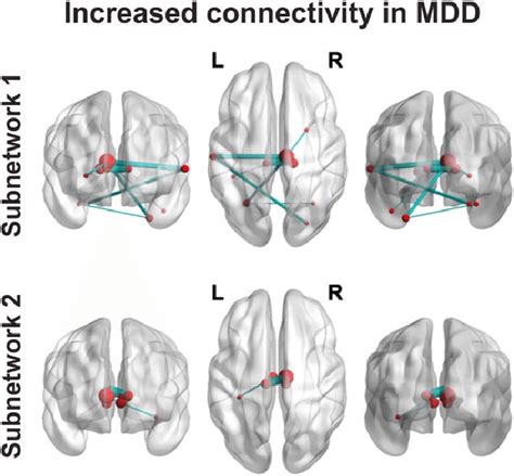 Summary Of Significant Networks That Characterize Patients With Major Download Scientific