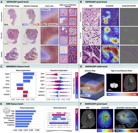 Artificial Intelligence For Multimodal Data Integration In Oncology