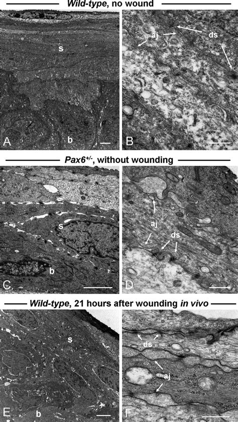 Ultrastructural Similarities Between Pax6 And Healing Wild Type