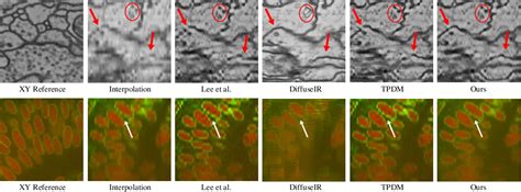 Reference Free Axial Super Resolution Of 3d Microscopy Images Using Implicit Neural