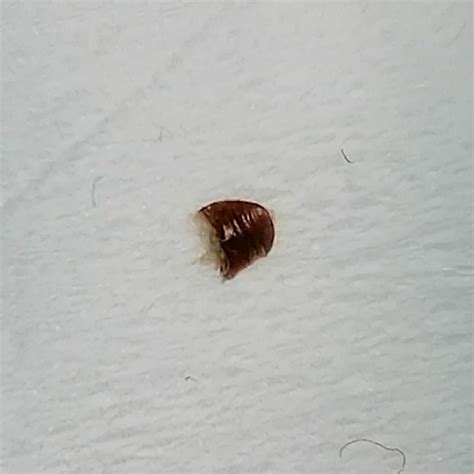 Could This Be A Bed Bug Shell Rbedbugs