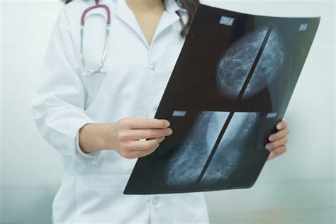 Interpretação da Mamografia como interpretar a classificação BI RADS