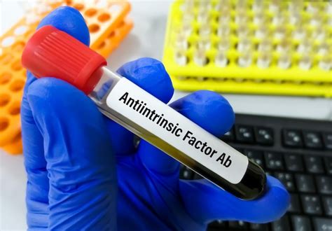 Prueba De Factor Intrínseco Ab Para Confirmar Un Diagnóstico De Anemia
