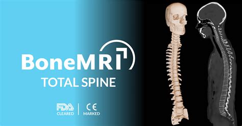 Bonemri For The Total Spine Mriguidance