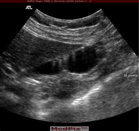 Abdominal Exam 1 Biliary Pathology Exam 4 Abdomen Liver Pathology