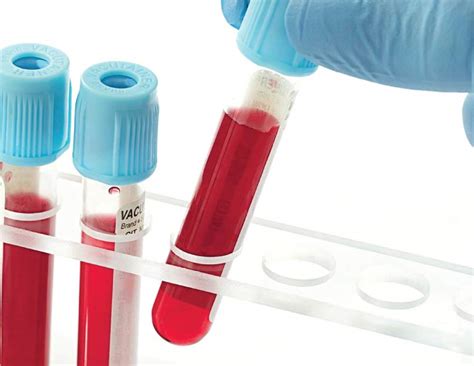 Tipos De Sangre Mi Devocional