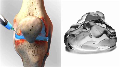 Anatomia do Joelho Clínica do Joelho