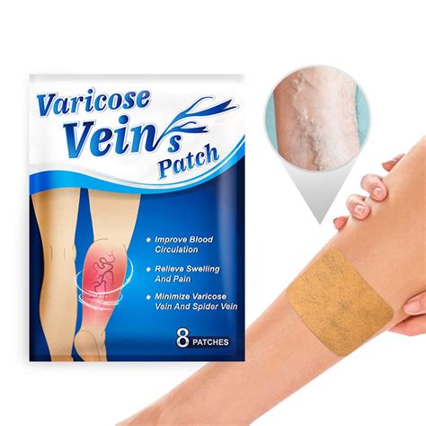 Buy Varicose Veins Cream Varicose Veins Cream For Legs Varicose Veins