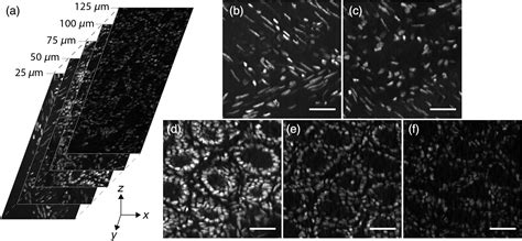 Tunable Structured Illumination Light Sheet Microscopy For Background