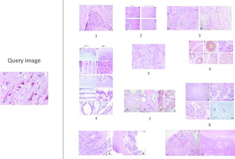 Sample Image Query And Results Provided With Content Based Retrieval