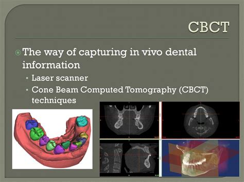 Tooth Segmentation From Cone Beam Computed Tomography Images Using The