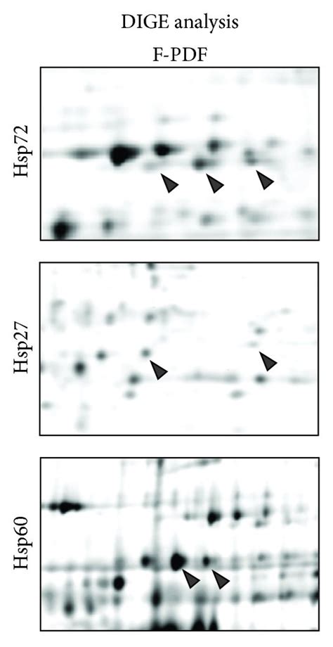 Two Dimensional Western Analysis Of The Chaperones Hsp70 Hsp27 And Download Scientific