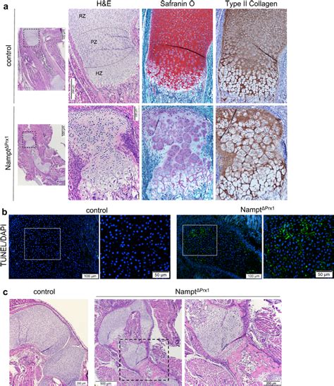 Nampt Deletion Promotes Growth Plate Chondrocyte Apoptosis And Disrupts