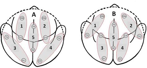 Temporal Spatial Quantification Of Neonatal Seizures