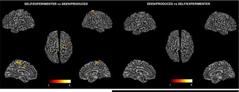 Activation Regions During Retrieval Of Origin N Context Stimuli Left Download Scientific