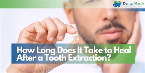How Long Does It Take To Heal After A Tooth Extraction Dental Magik