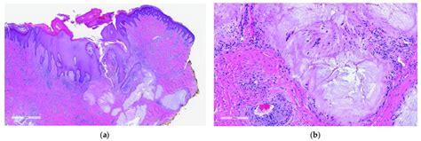 A Hematoxylin And Eosin Stained Skin At Low Magnification Shows