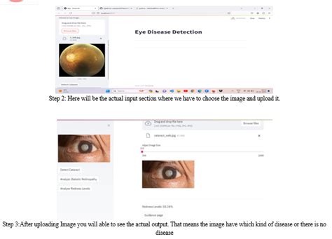 Eye Disease Detection System