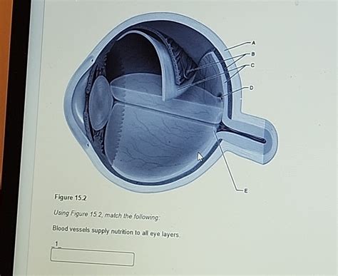 Solved Figure 152using Figure 152 ﻿match The