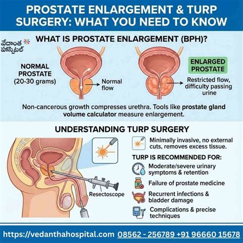 Prostate Enlargement Turp Surgery Top 10 Key Differences