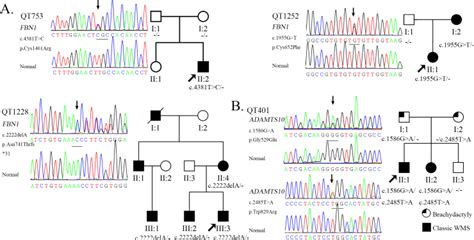 Novel Mutations Identified In Fbn1 And Adamts10 Genes A Sequence