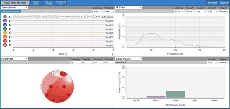 Eeg Signal From Openbci Board A Textile Based Head Phantom B