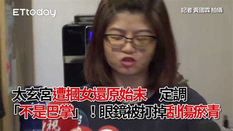 太玄宮遭摑女還原始末 定調「不是巴掌」！眼鏡被打掉刮傷瘀青 播吧boba Ettoday新聞雲