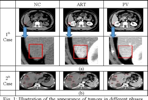 Figure 1 From Multi Stream Scale Insensitive Convolutional And Recurrent Neural Networks For