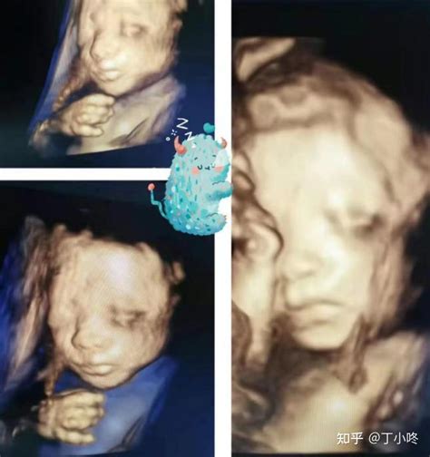 老爸测评推荐的DHA这么多人买 孕妇DHA哪个牌子好 知乎