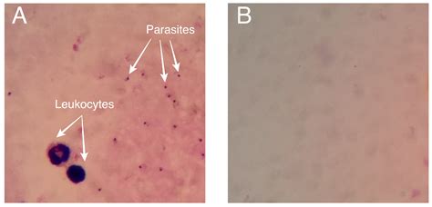 Supporting Malaria Diagnosis Using Deep Learning And Data Augmentation
