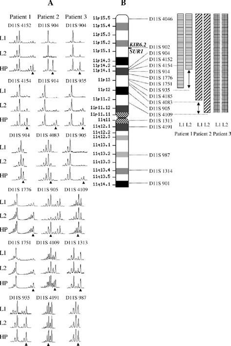 Figure 3 From The Knudsons Two Hit Model And Timing Of Somatic