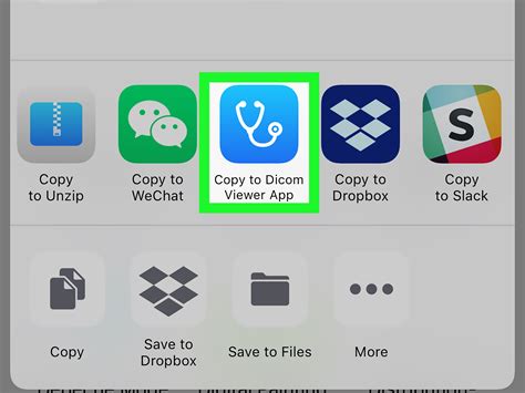How To Open A Dicom File On IPhone Or IPad Steps