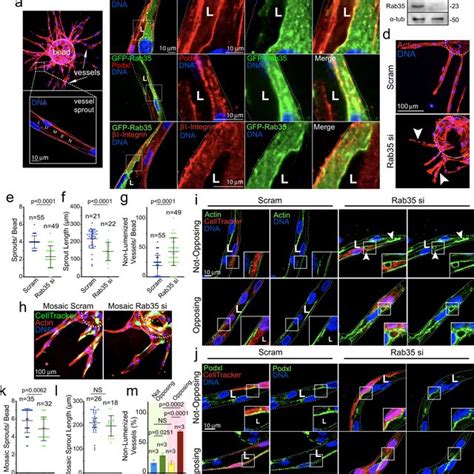 Rab35 Is An Apical Membrane Protein Required For Sprout Formation A Download Scientific Diagram