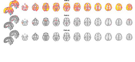 Mediationbrainresultsreport