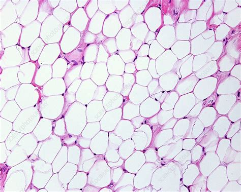 Adipose Tissue Light Micrograph Stock Image C0506294 Science Photo Library