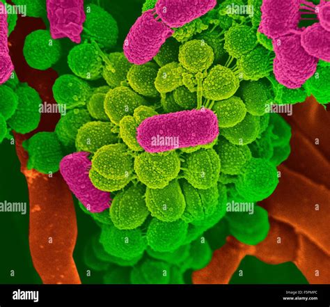 Oral Bacteria Coloured Scanning Electron Micrograph Sem Of Mixed Oral Bacteria Cocci And