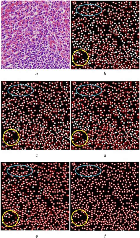 Comparative Nuclei Detection Performance Illustration For Different Download Scientific Diagram